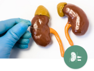 Kidney Treatments | Kidney Health Care Clinic