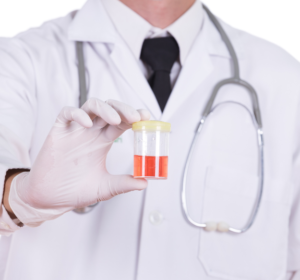 Proteinuria - Bubbling In Urine | Kidney Health Care Clinic