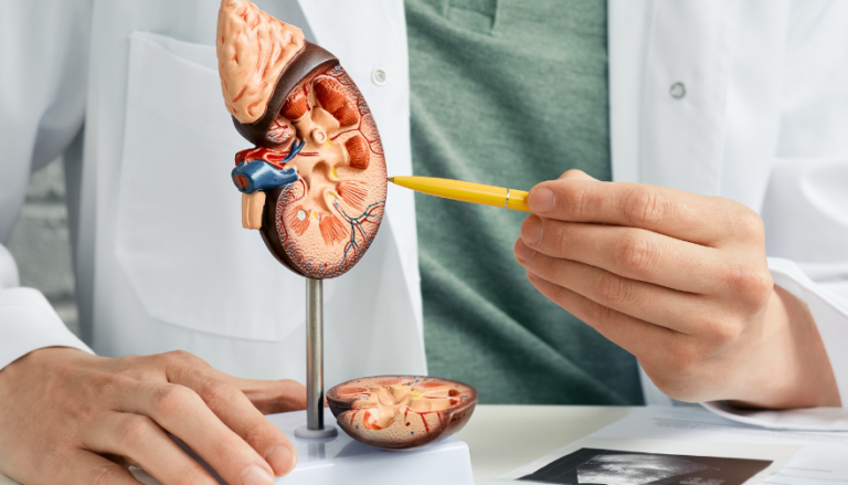 Proteinuria: What You Need to Know about Protein in Urine